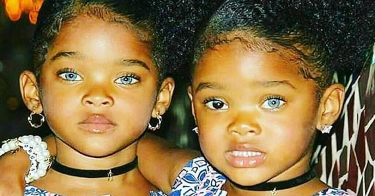 Gemelle travolgono i social con la loro rara e unica bellezza. Oggi ...