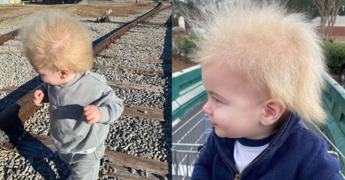 Locklan è 1 dei 100 bambini al mondo con "la sindrome dei capelli non ...